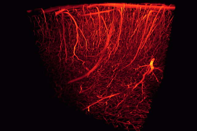 Researchers are on a path to 3D-printed veins that could change ...